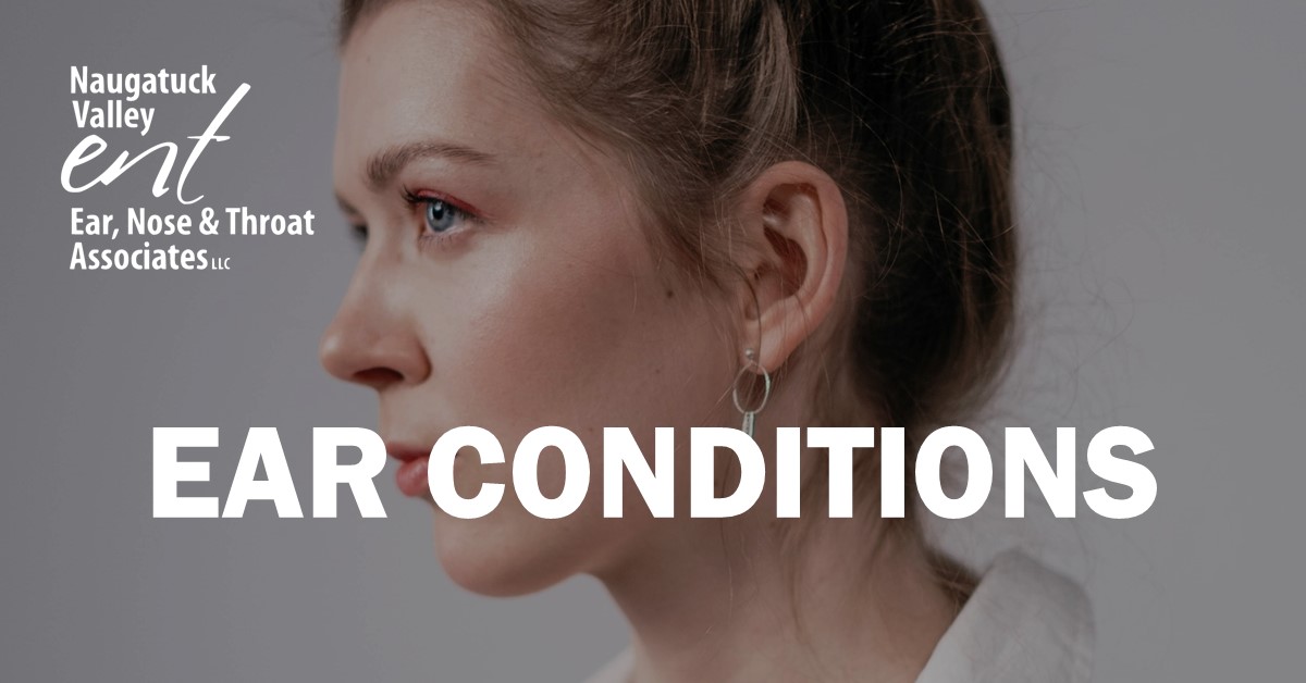 Ear Conditions | Naugatuck Valley ENT