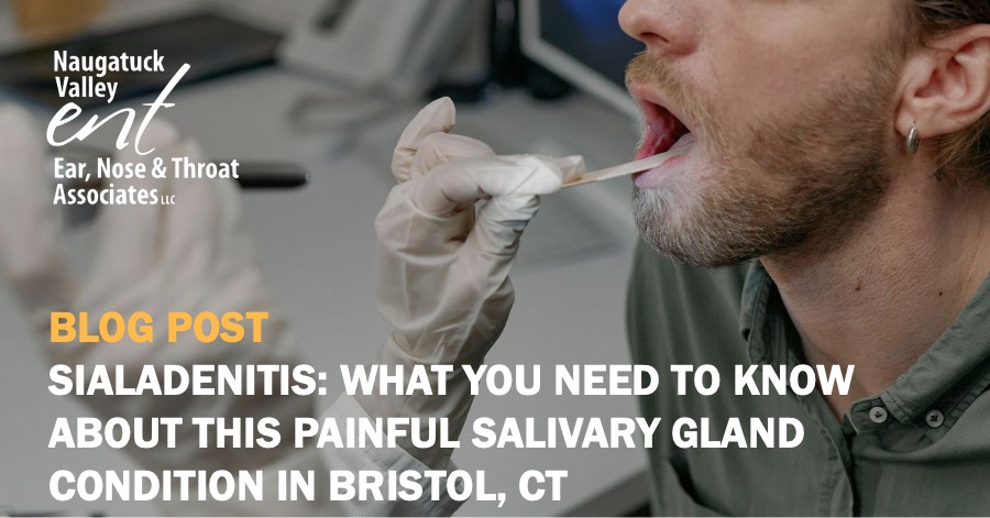 Sialadenitis: What You Need to Know About This Condition in Bristol, CT
